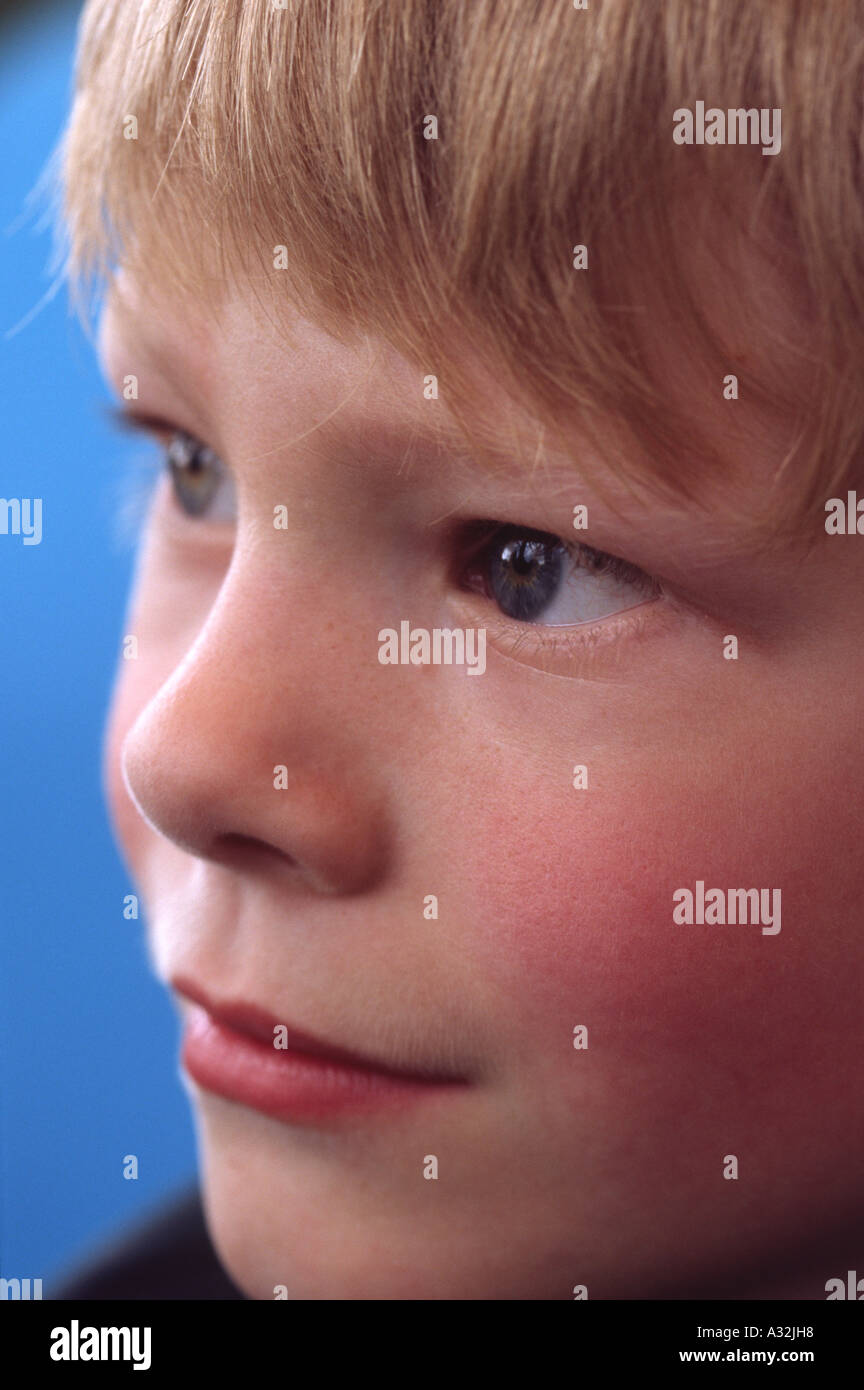 Ruddy complexion hi-res stock photography and images - Alamy