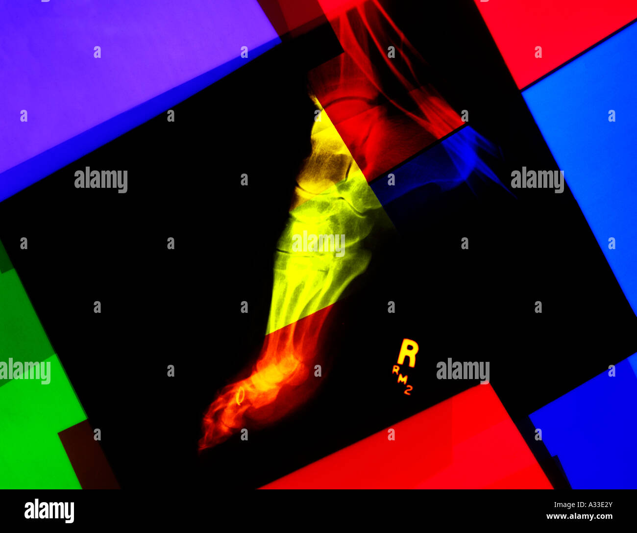A colorful X Ray of a foot Stock Photo - Alamy