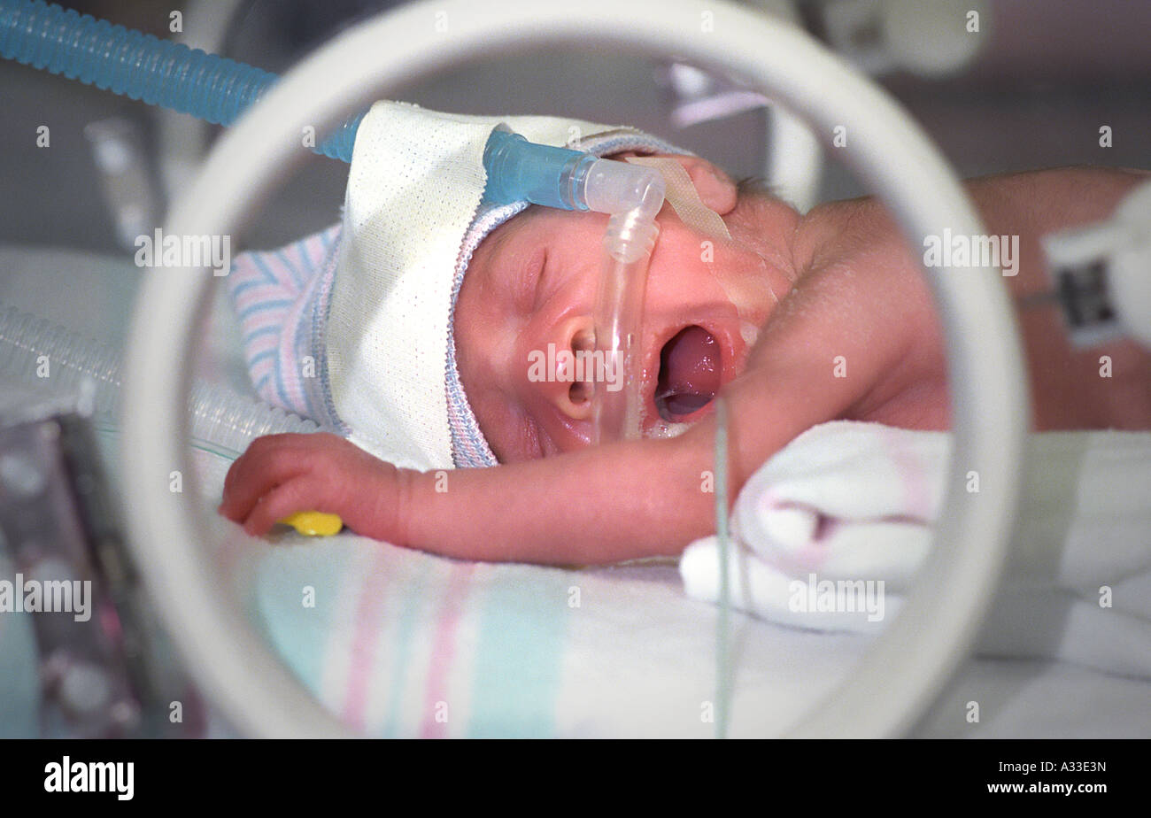 A yawning premie baby in an incubator Stock Photo - Alamy