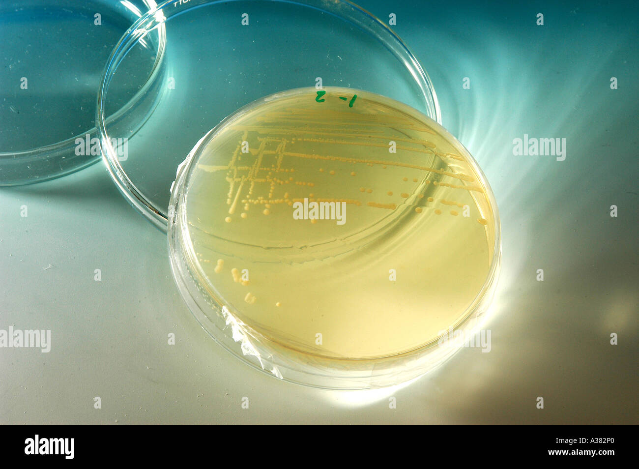 Escherichia coli bakterien hi-res stock photography and images - Alamy