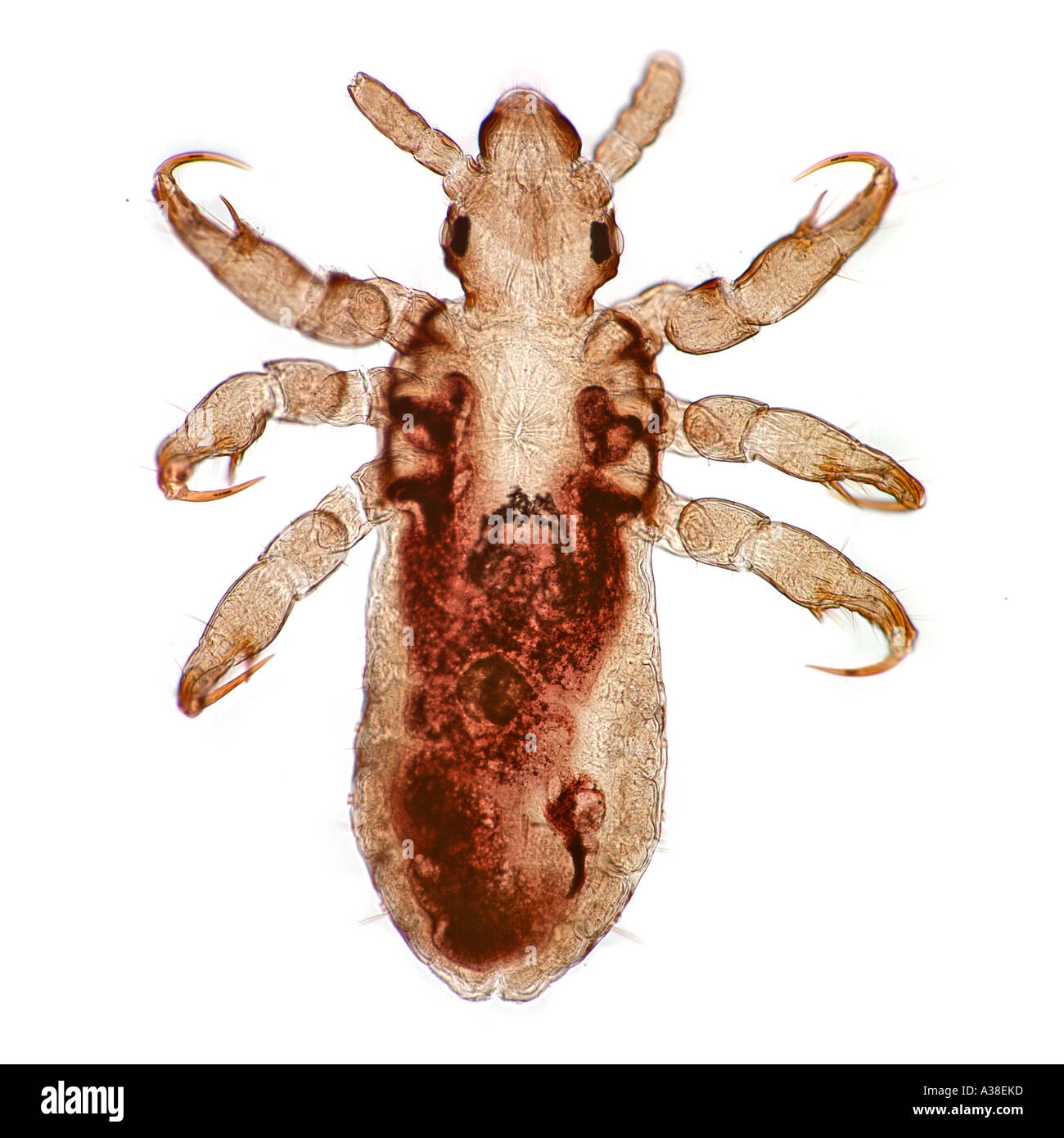 Pediculus capitis hi-res stock photography and images - Alamy