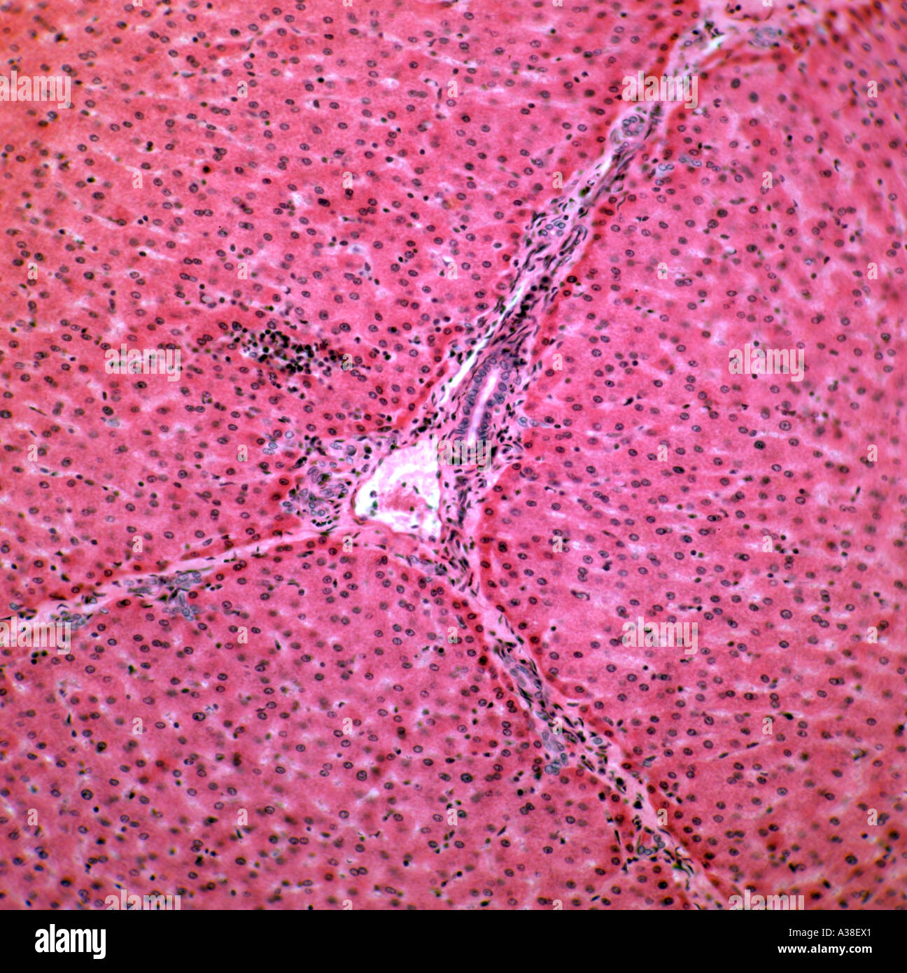 Liver section hi-res stock photography and images - Alamy