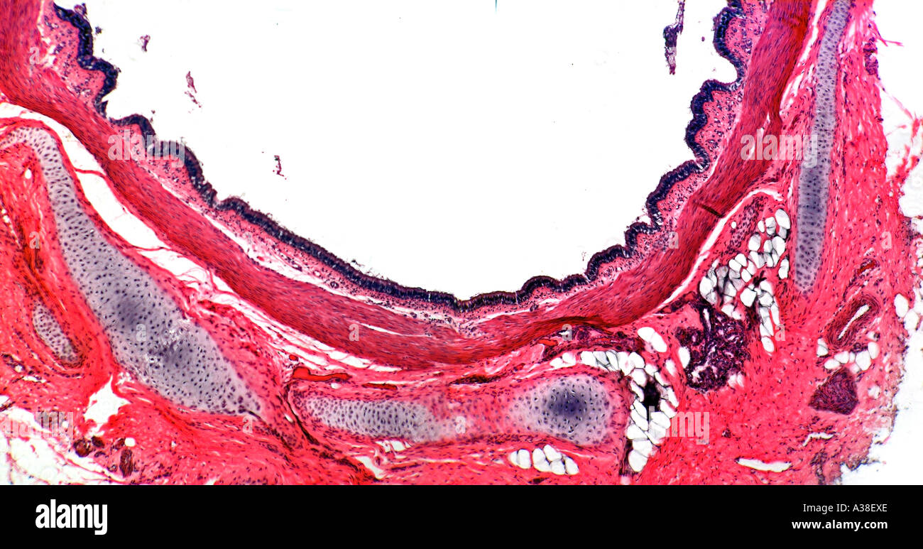 Human bronchi partial section brightfield photomicrograph Stock Photo ...