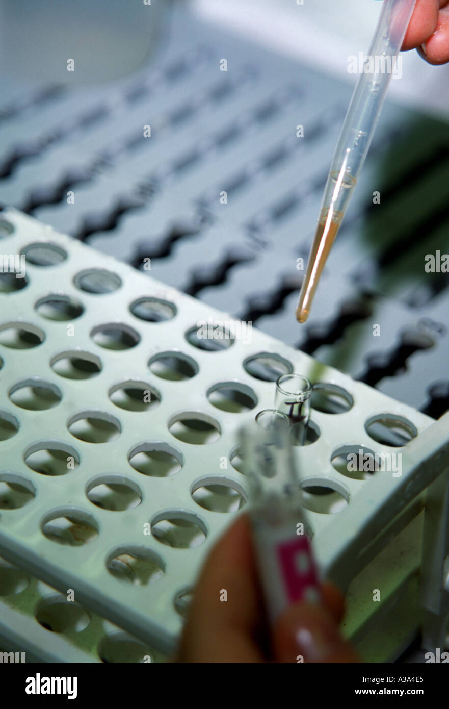 Plasma sampling in laboratory tubes 1302 Stock Photo - Alamy