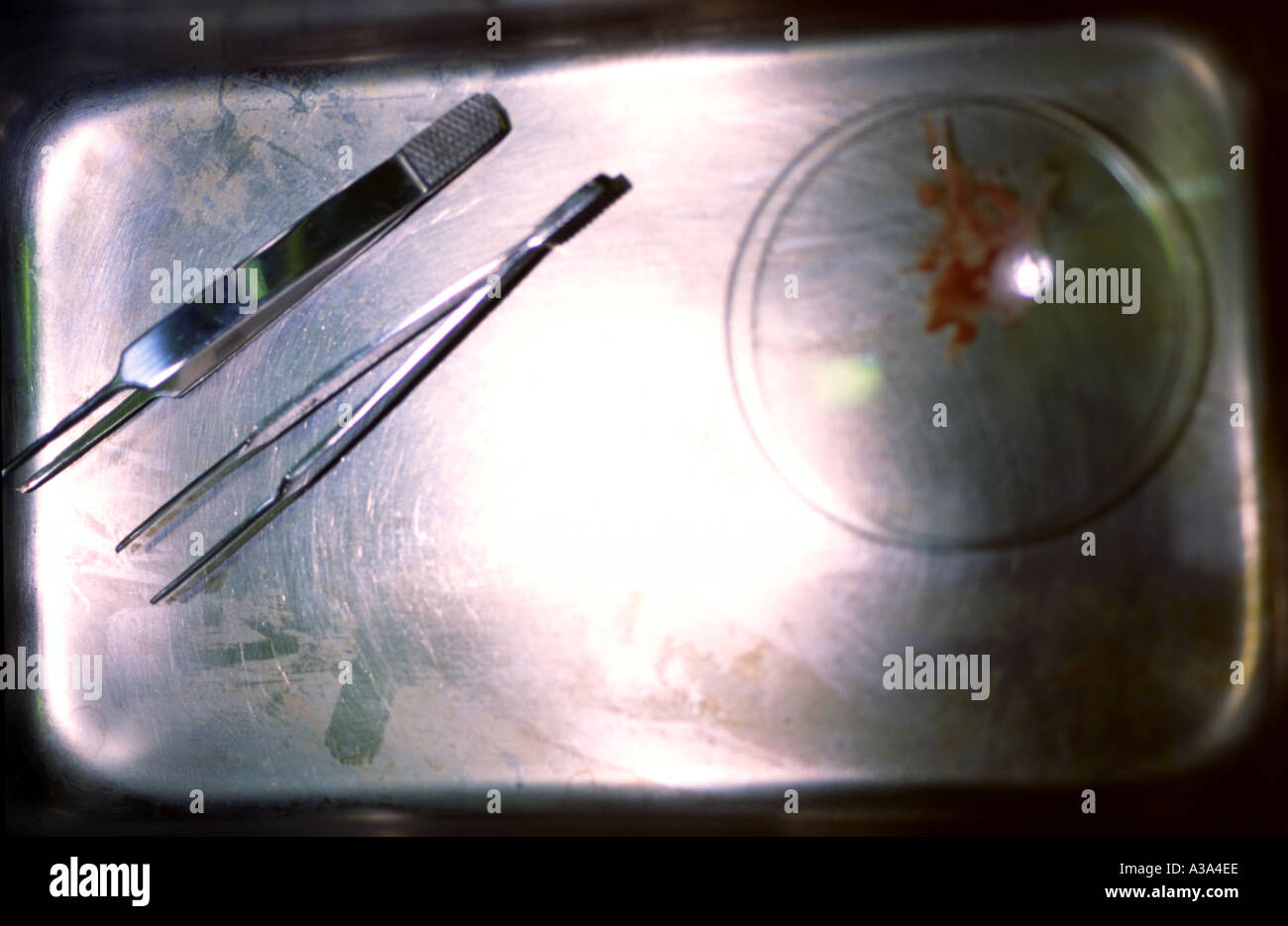 Tissue sampling hi-res stock photography and images - Alamy