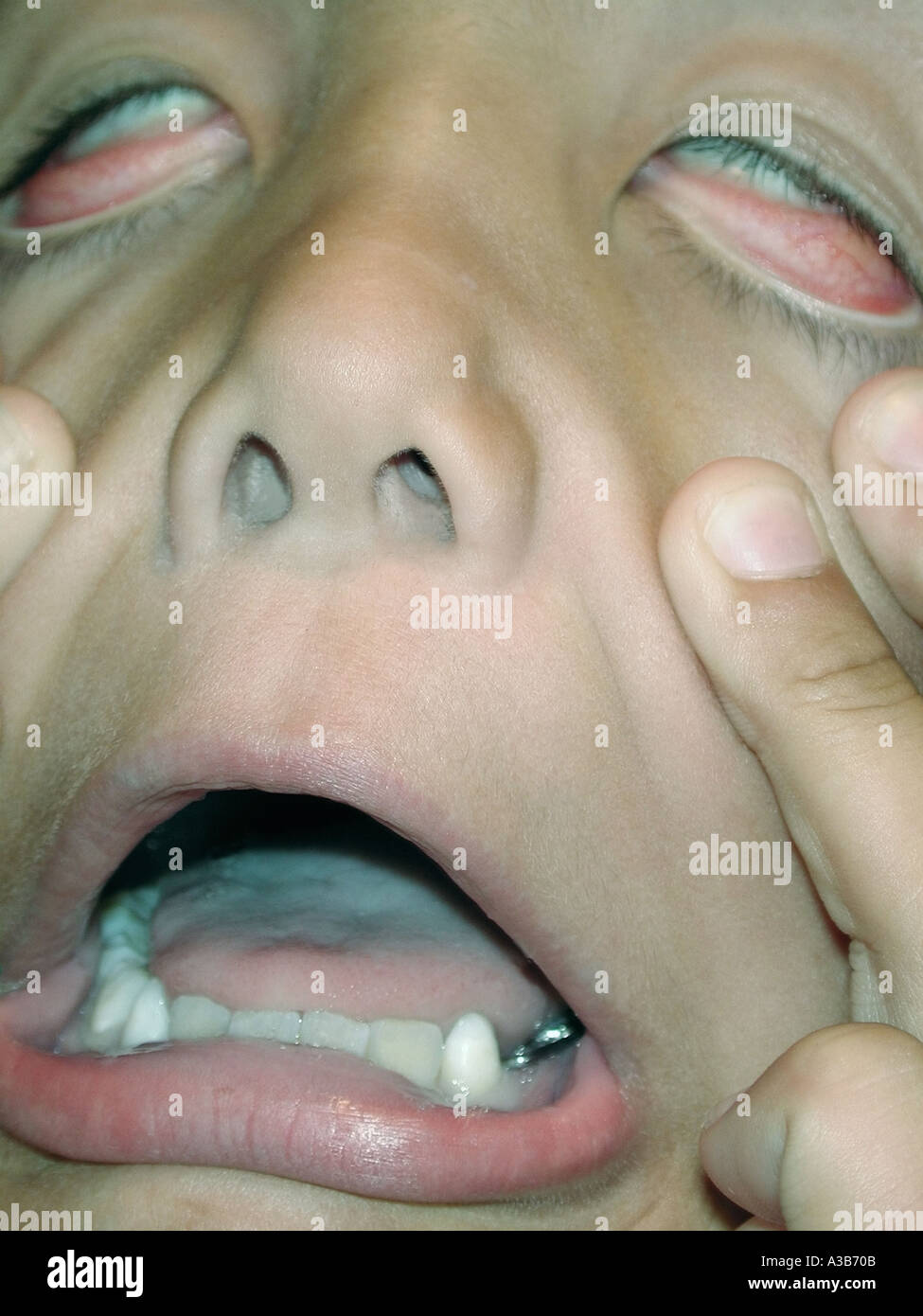 Ten year old boy making scary face close up Stock Photo - Alamy