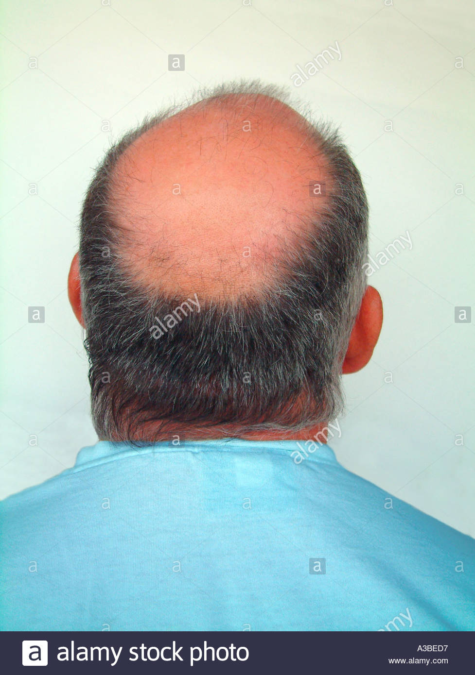 Bald Shiny Head High Resolution Stock Photography and Images - Alamy
