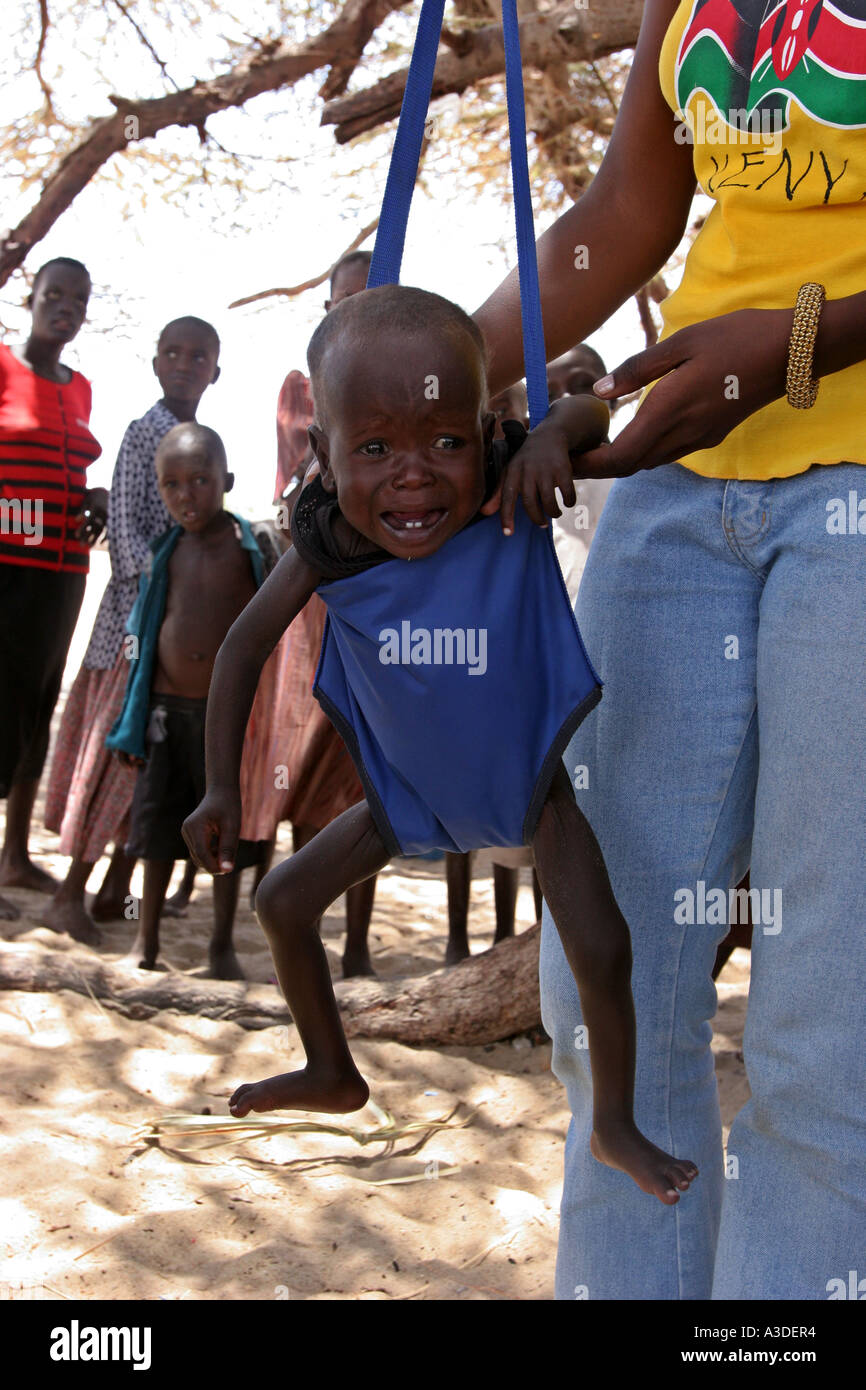 Child being weighed check malnutrition hi-res stock photography and ...