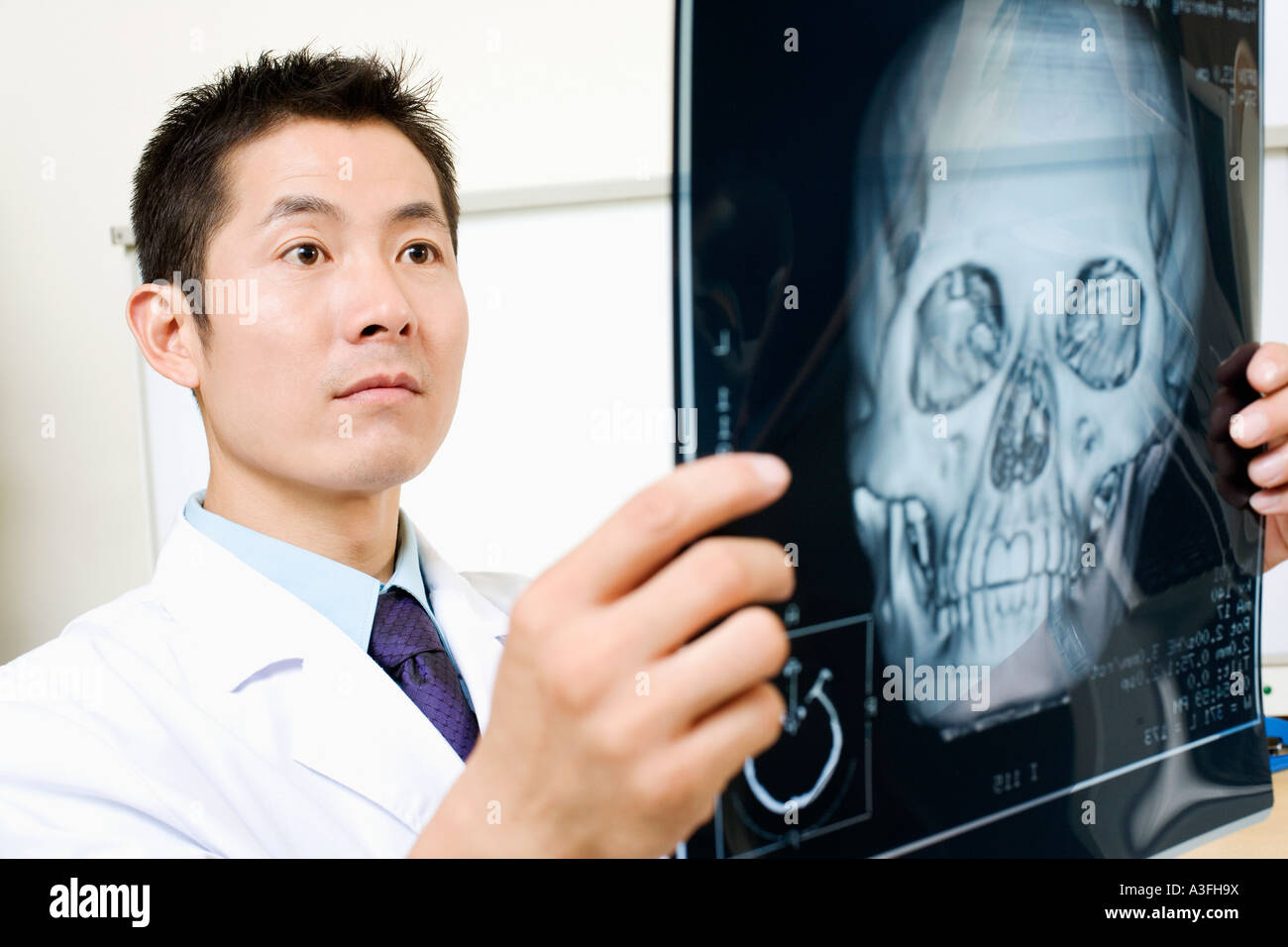 Close-up of a male doctor holding an X-Ray image Stock Photo - Alamy