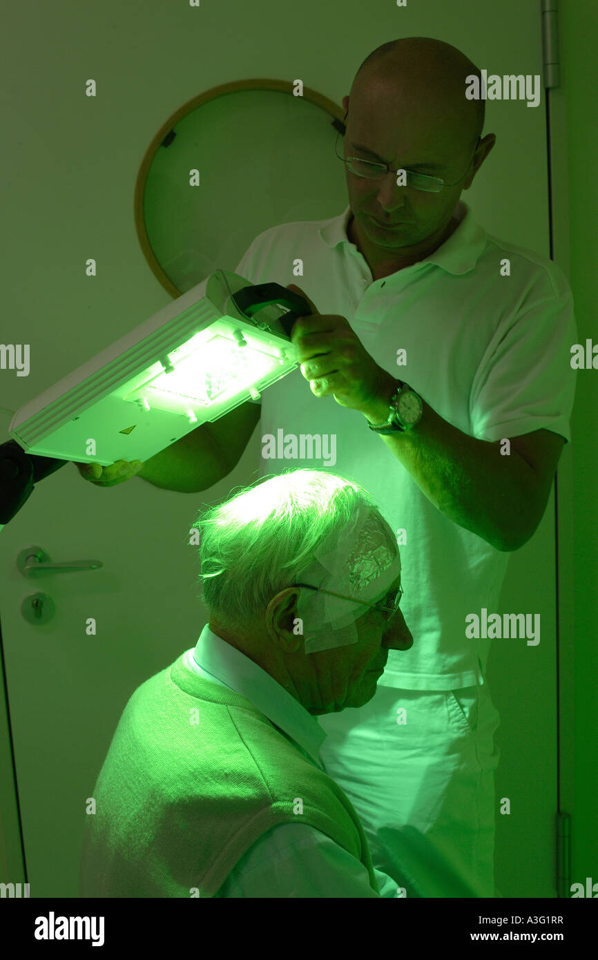 Photo dynamic skin cancer therapy Stock Photo - Alamy
