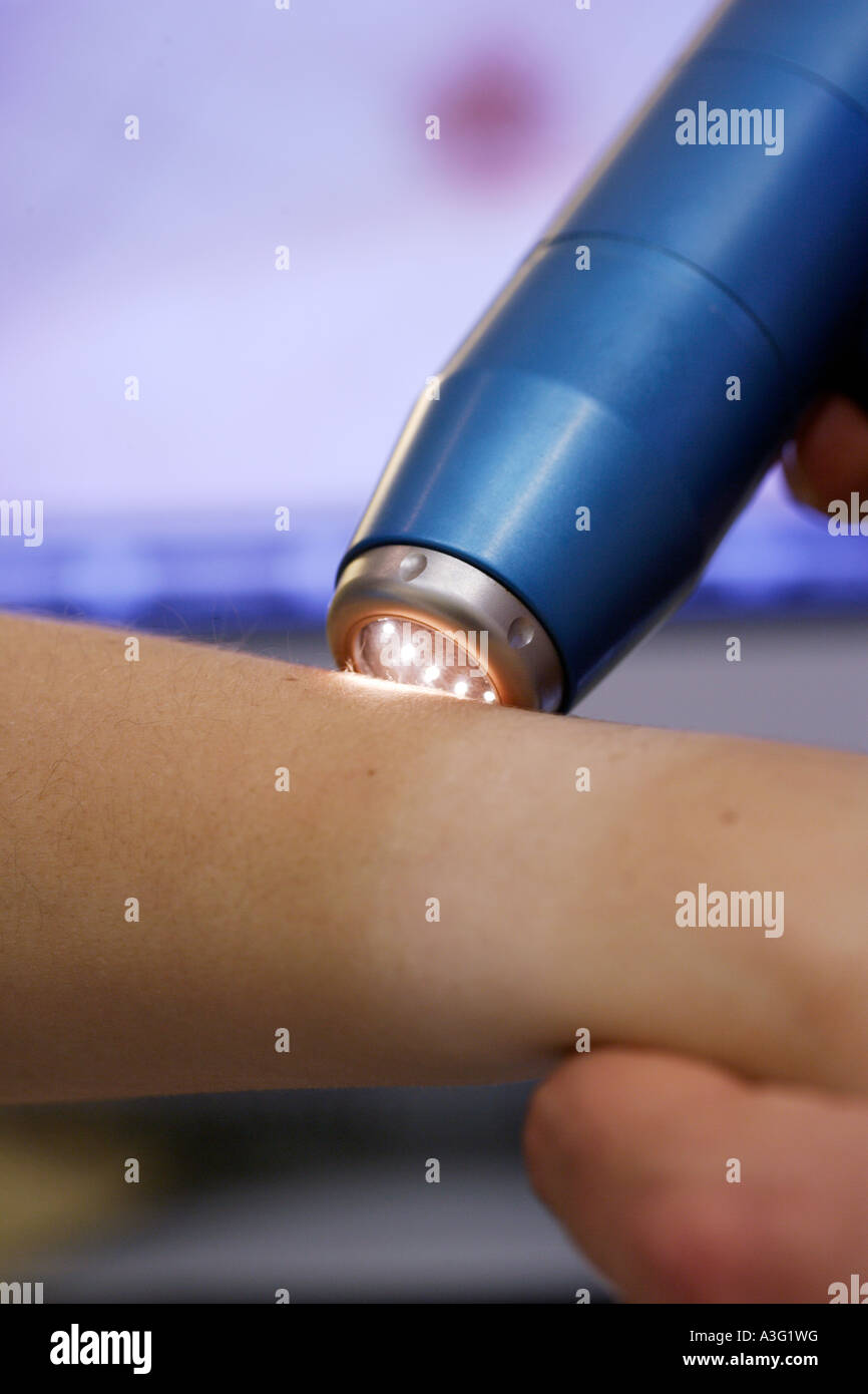 Dermatoskop hi-res stock photography and images - Alamy
