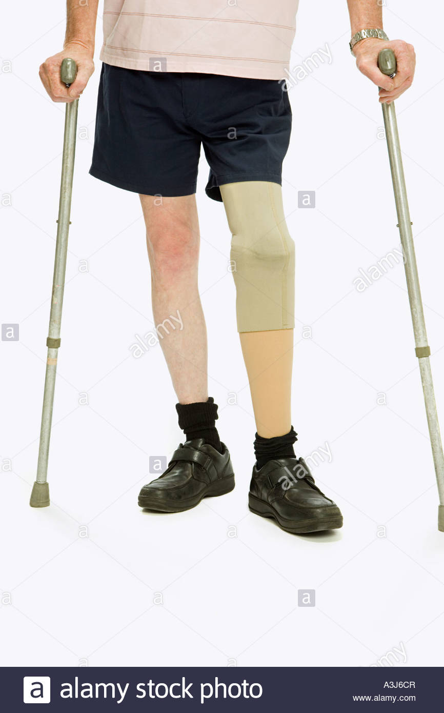 Human Limb Stock Photos & Human Limb Stock Images - Alamy