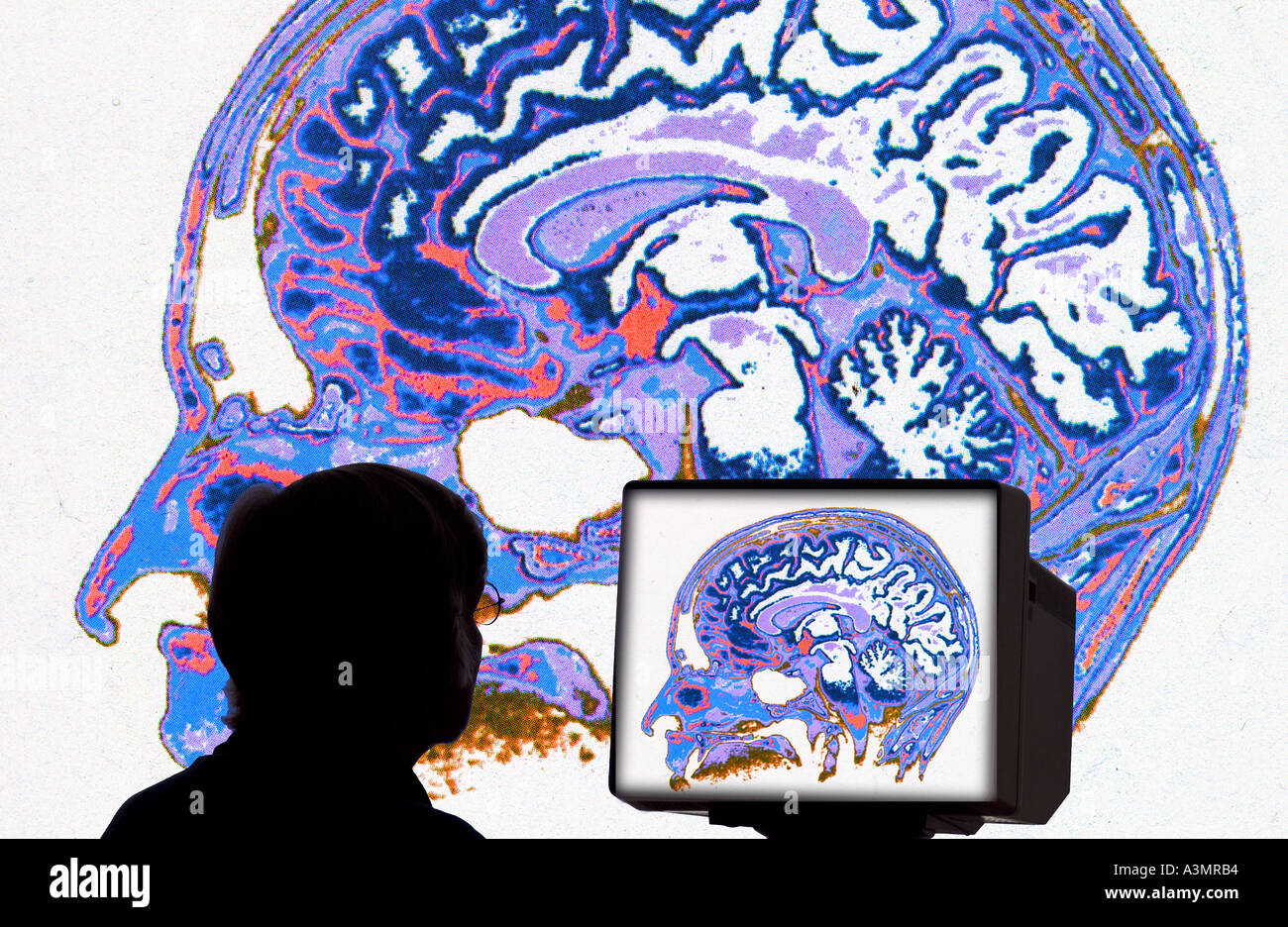 Human skull and computer circuit board hi-res stock photography and ...