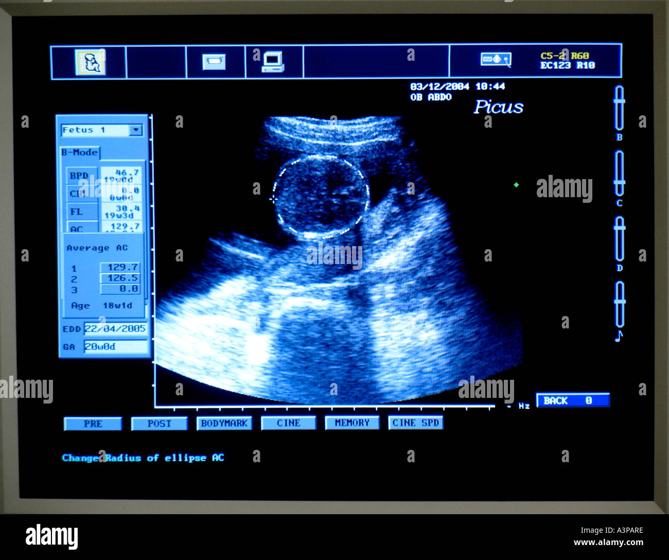 Ultrasonic testing hi-res stock photography and images - Alamy