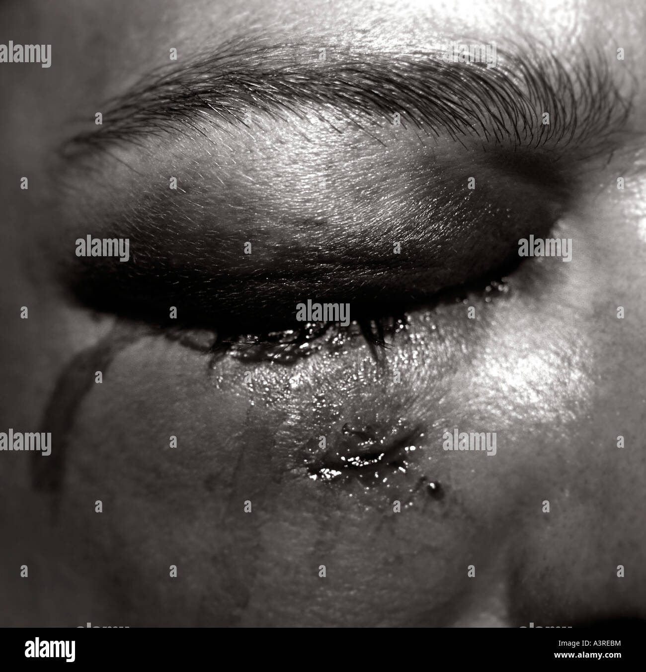 Battered woman battered woman black eye hi-res stock photography and ...