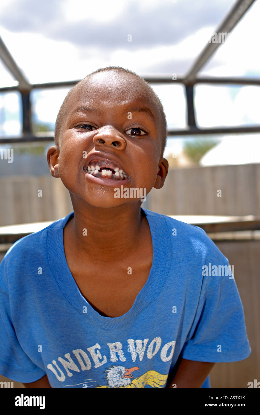 Toothless Kenyan boy making funny faces Maralal Northern Kenya Stock ...