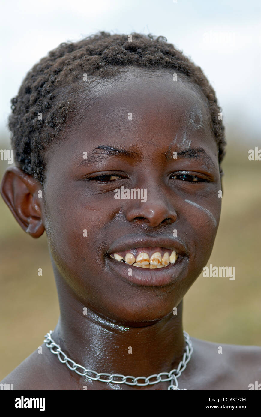 Smiling Kenyan boy with discolored teeth Lake Naivasha Kenya Stock ...