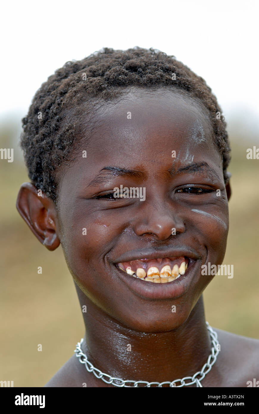 Smiling Kenyan boy with discolored teeth Lake Naivasha Kenya Stock ...