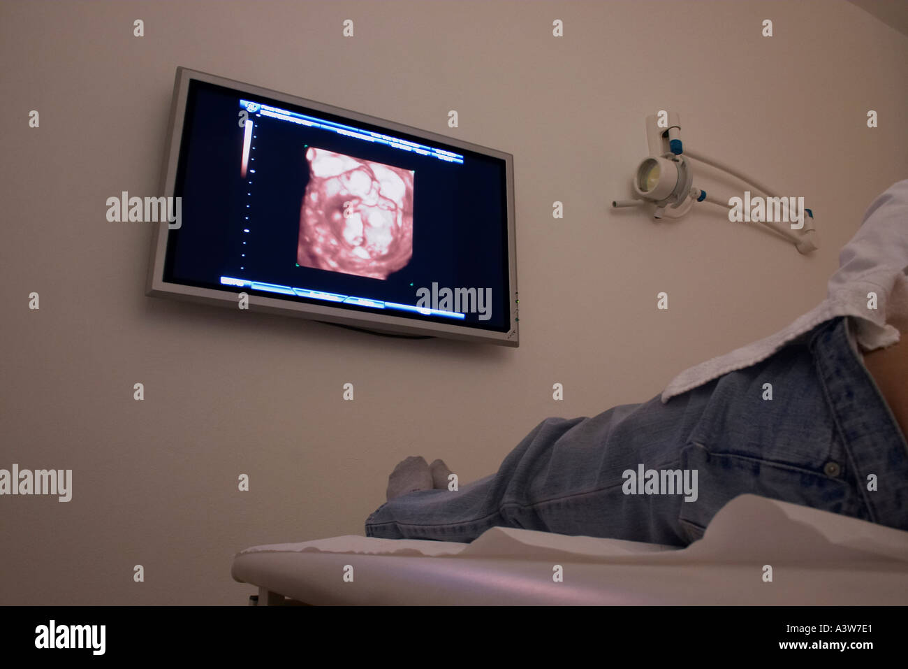 3D ultrasonic scan, 15th week Stock Photo - Alamy