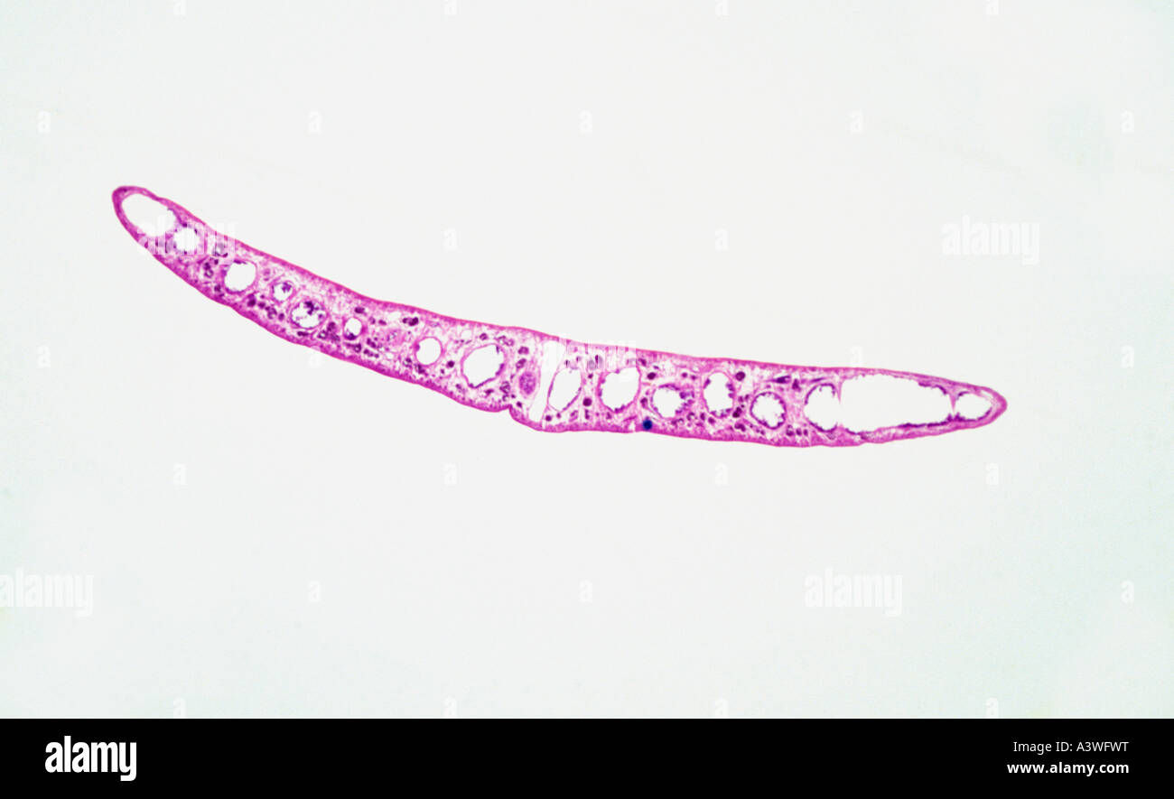 Fluke Under Microscope