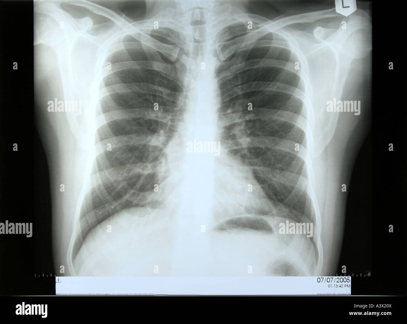 male torax xray with space to fill in data Stock Photo - Alamy