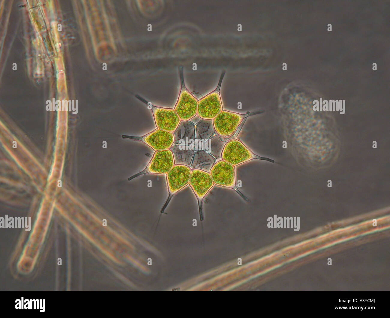 Pediastrum simplex (Pediastrum simplex), with phase-contrast MRI, multi ...