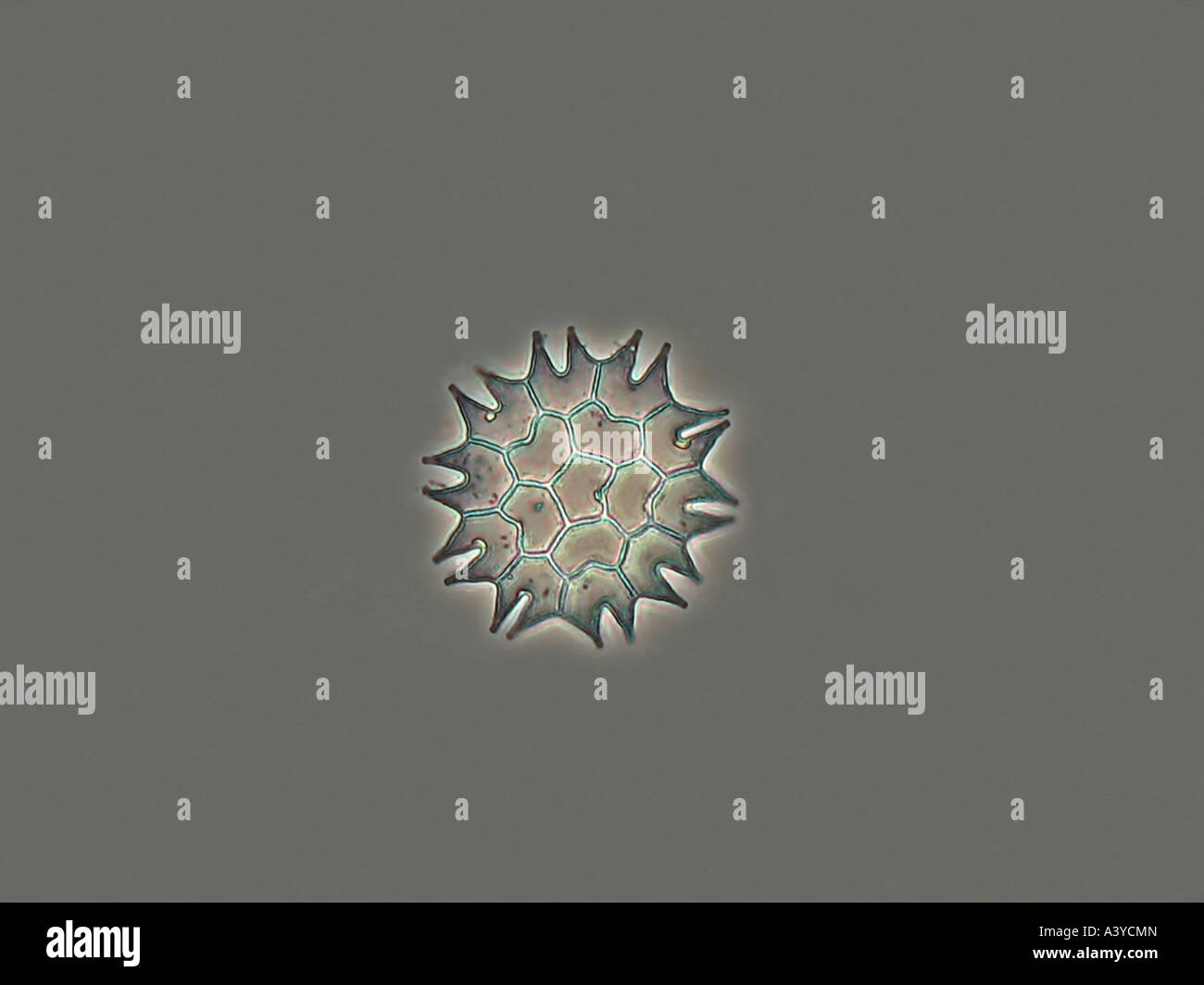 Pediastrum boryanum (Pediastrum boryanum), with phase-contrast MRI, 16 ...