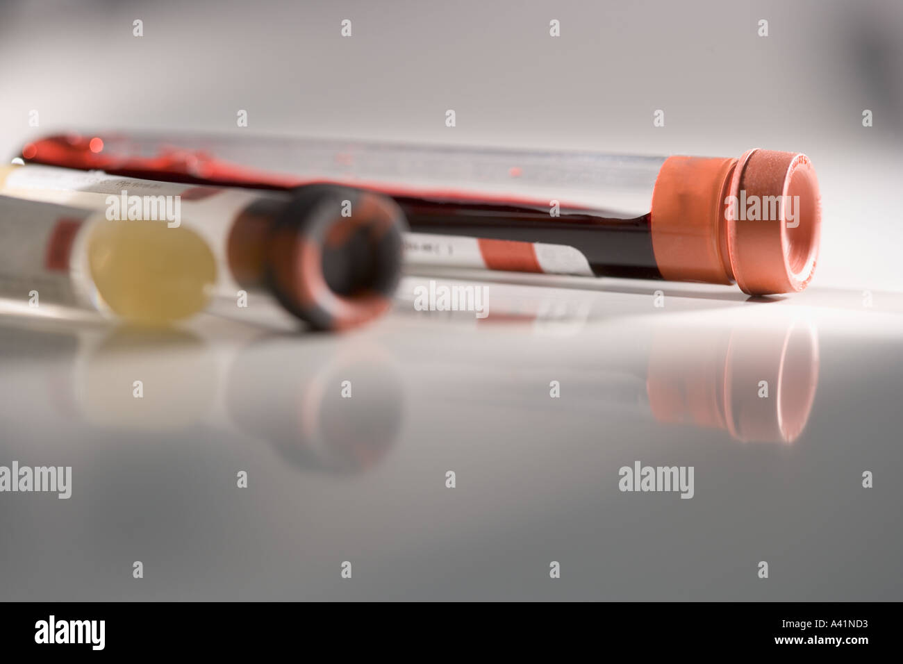 Blood samples in tubes hi-res stock photography and images - Alamy