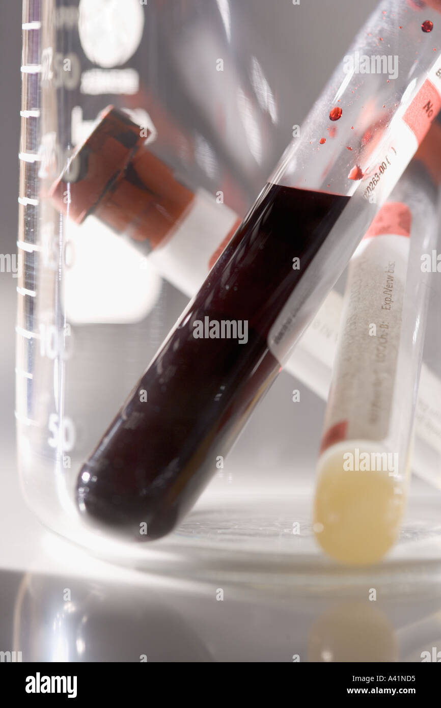 Closeup of blood samples in tubes Stock Photo - Alamy
