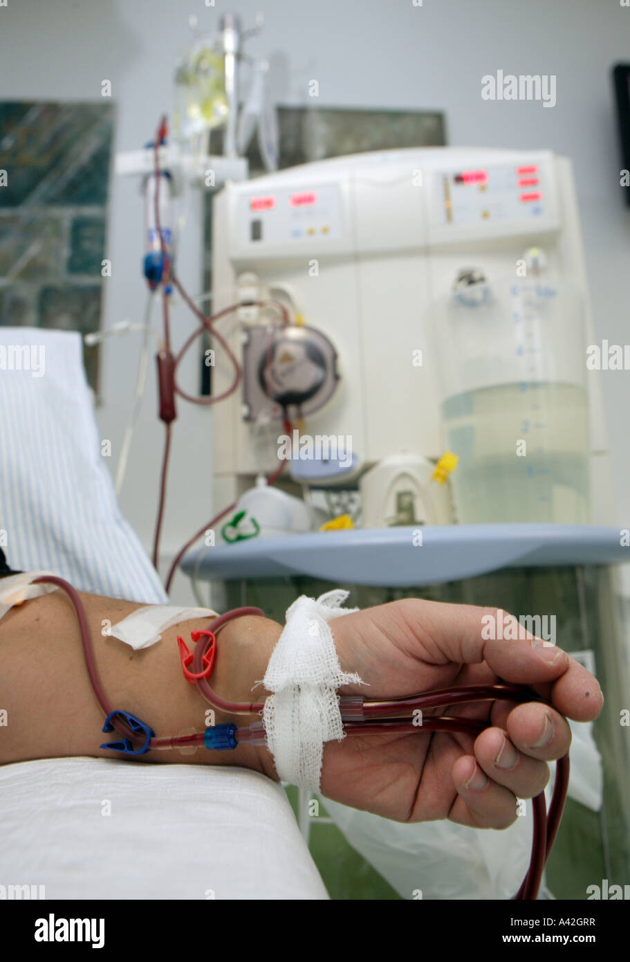 Kidney dialysis machine hi-res stock photography and images - Alamy