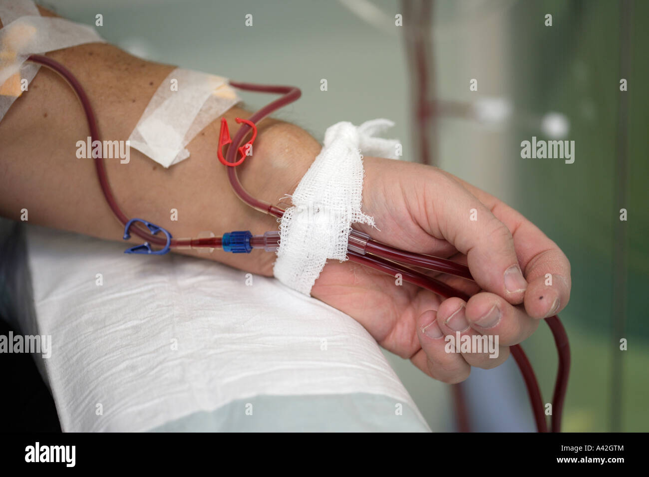 Patients during dialysis hi-res stock photography and images - Alamy