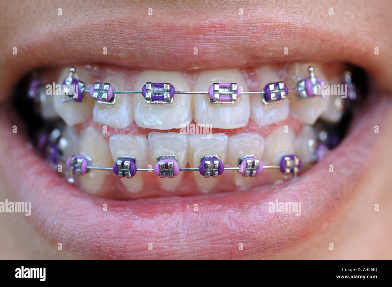 smile with confidence Stock Photo - Alamy