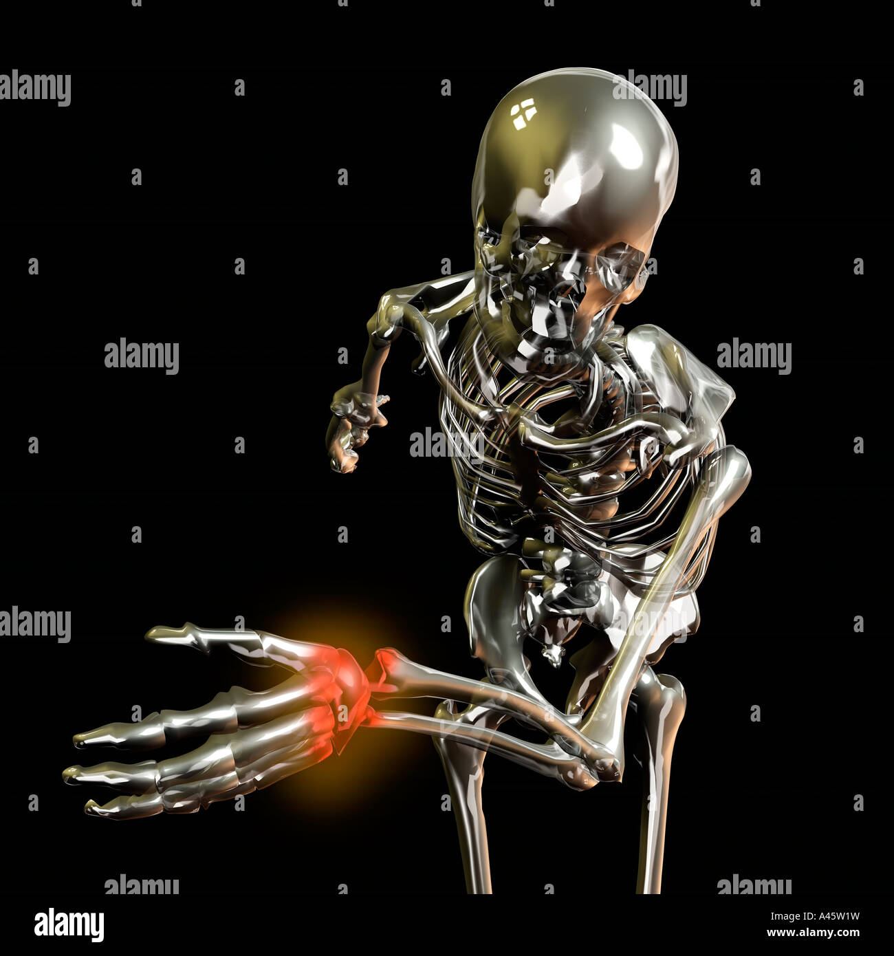 Skeleton Demonstrating Wrist Pain Stock Photo - Alamy