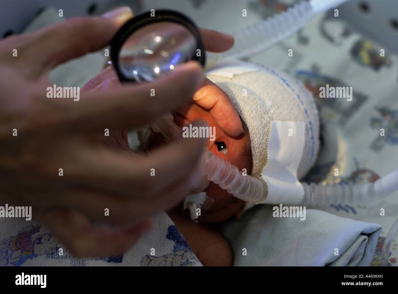Eye examination on a premature infant at the intensive care, Recife ...