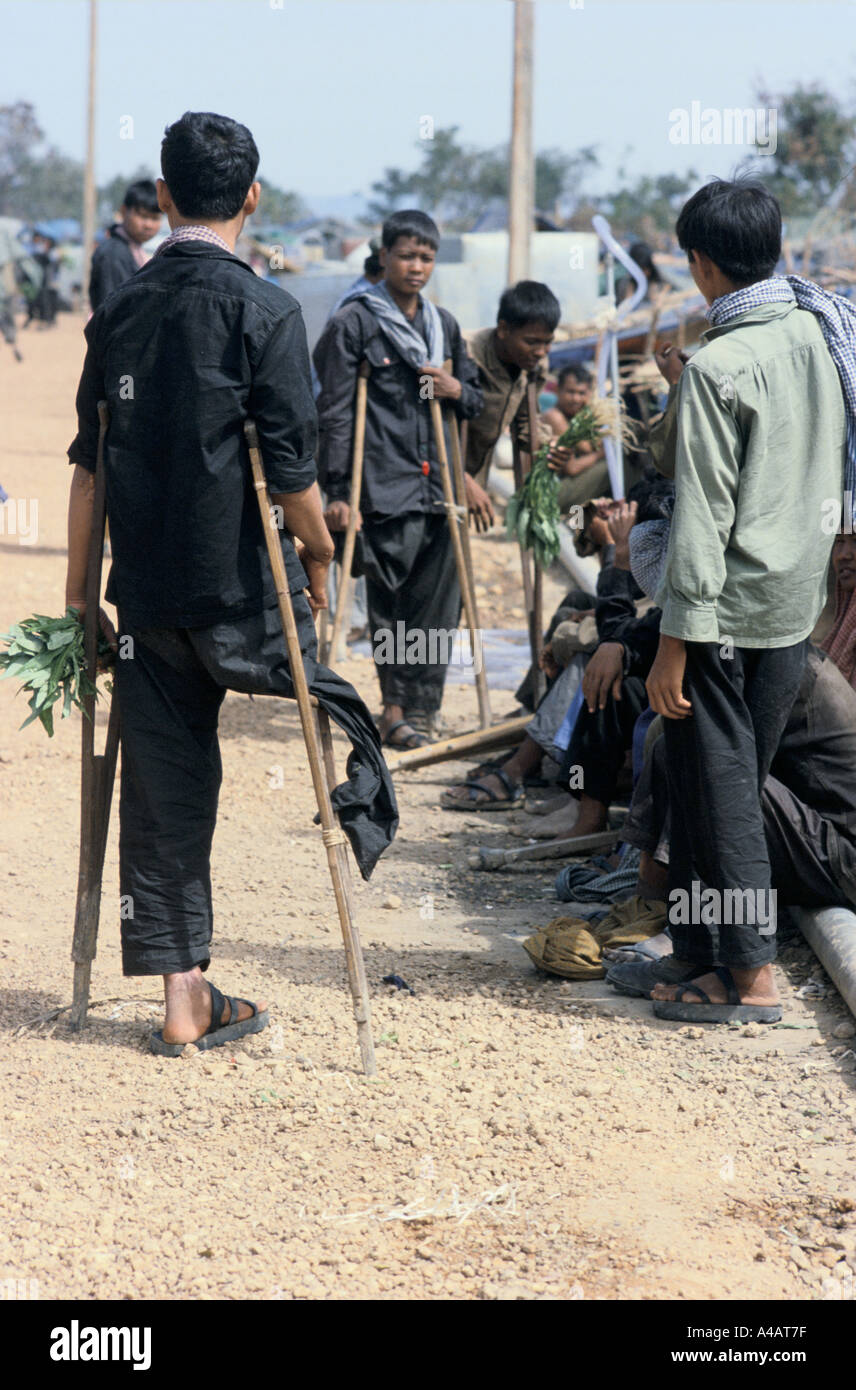 Young amputees at Nong Samet refugee camp on the Thai-Cambodian border ...