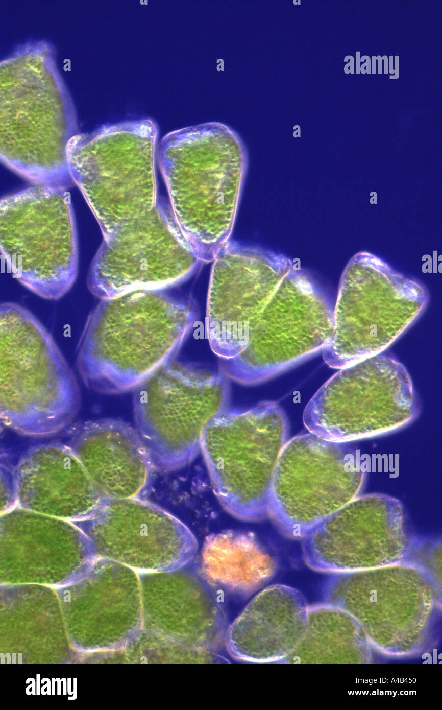 Photomicrograph of living ciliated colonial protozoan carchesium Stock ...