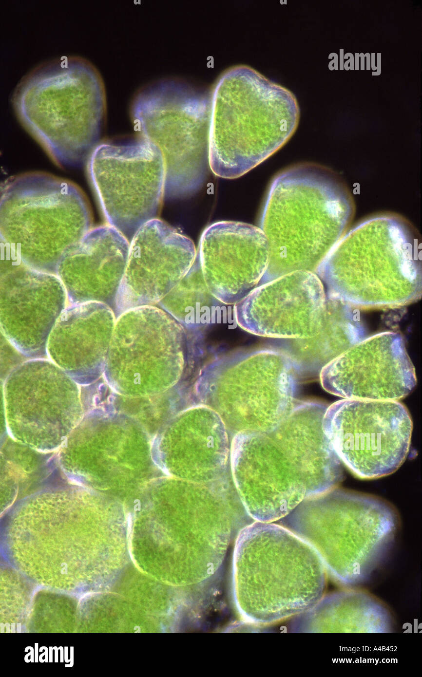 Photomicrograph of living ciliated colonial protozoan carchesium Stock ...