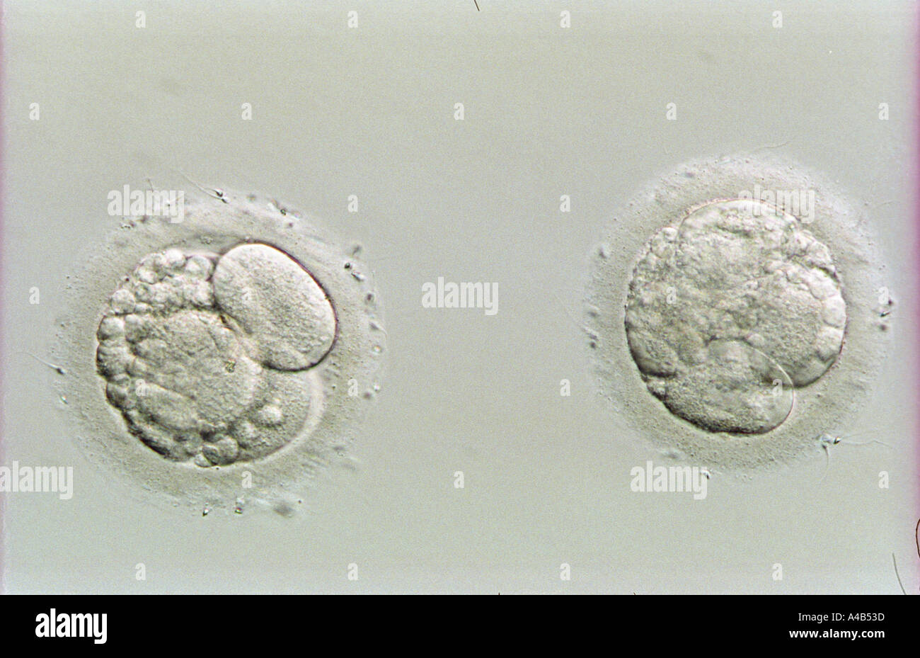 Human embryos cells development hi-res stock photography and images - Alamy