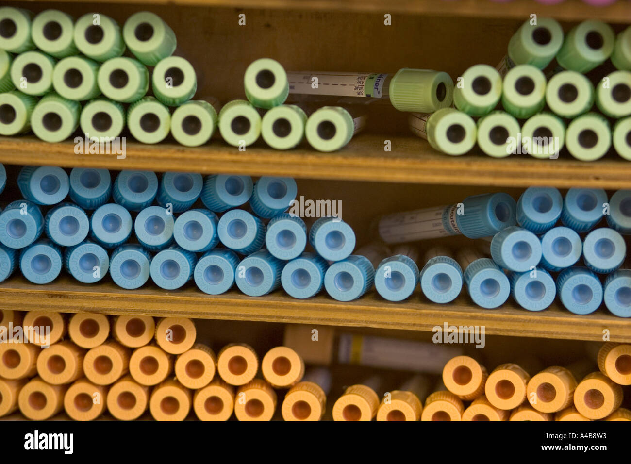 blood testing equipment sample bottles at st marys hospital london ...