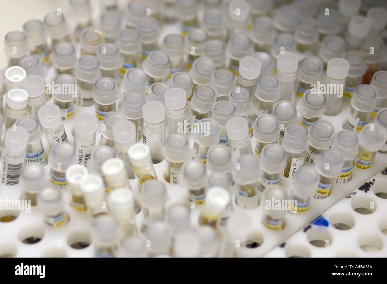 automated blood testing equipment at st marys hospital london Stock ...