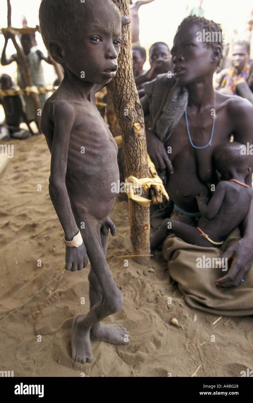 famine southern sudan medicine sans frontier clinic malnorished boy ...