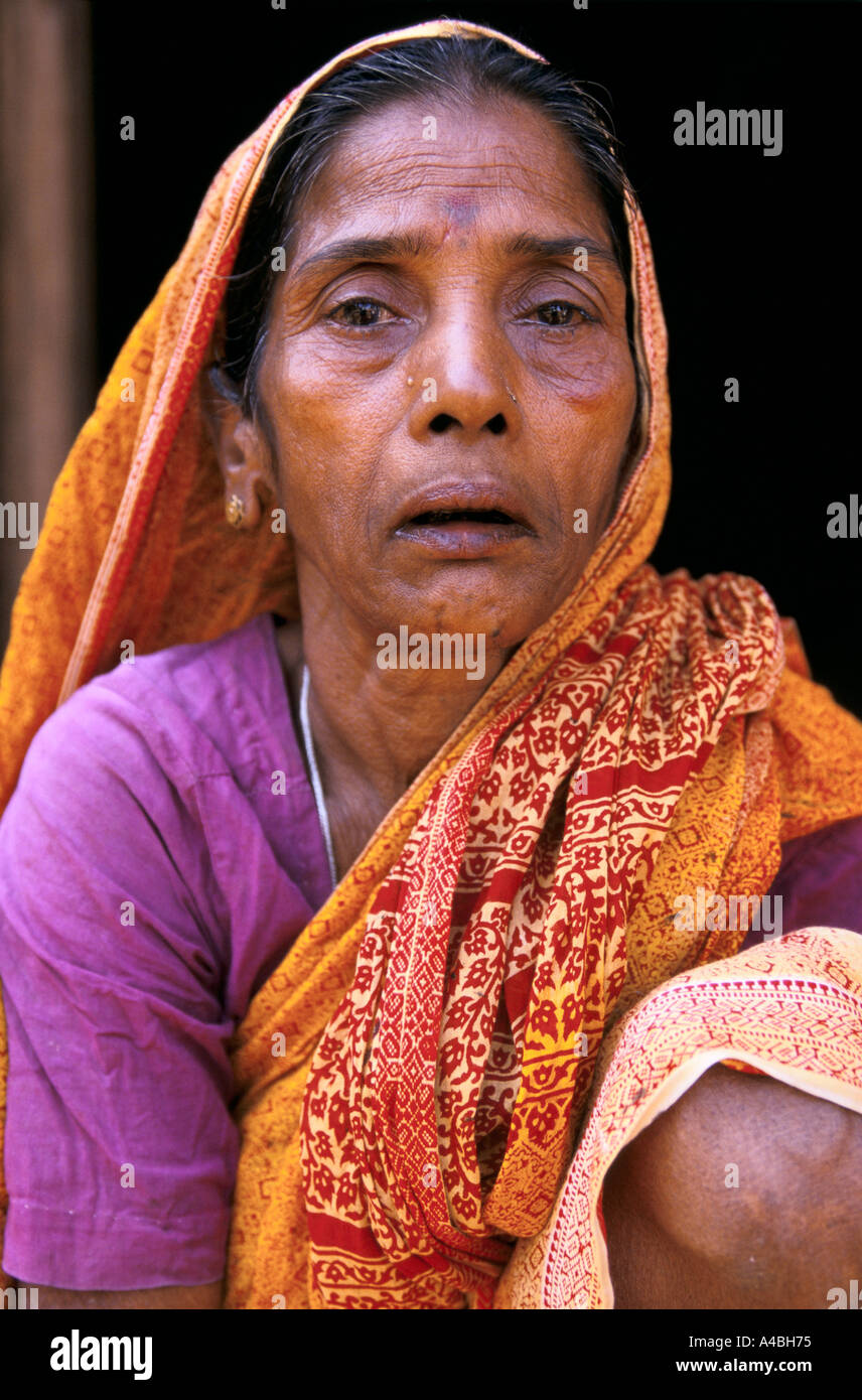 Orissa Cyclone, India, 1999 A week after, a woman displays the trauma ...