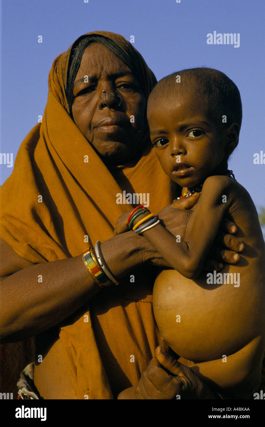 mother and malnourished child eritrean famine eritrea Stock Photo - Alamy