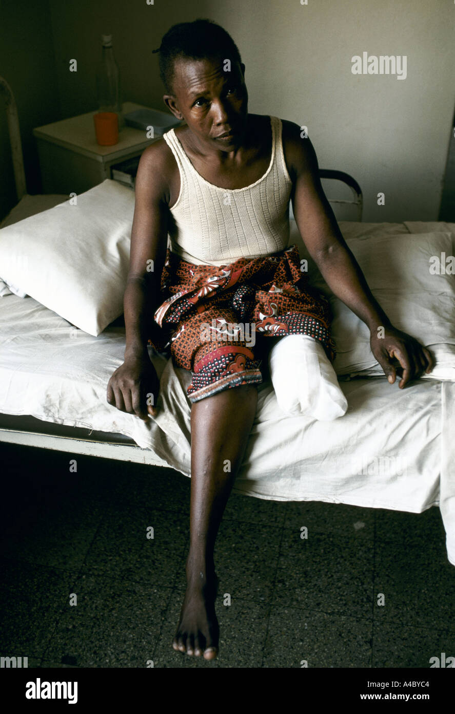 A man with an amputated leg at a red cross clinic . 90 patients have ...