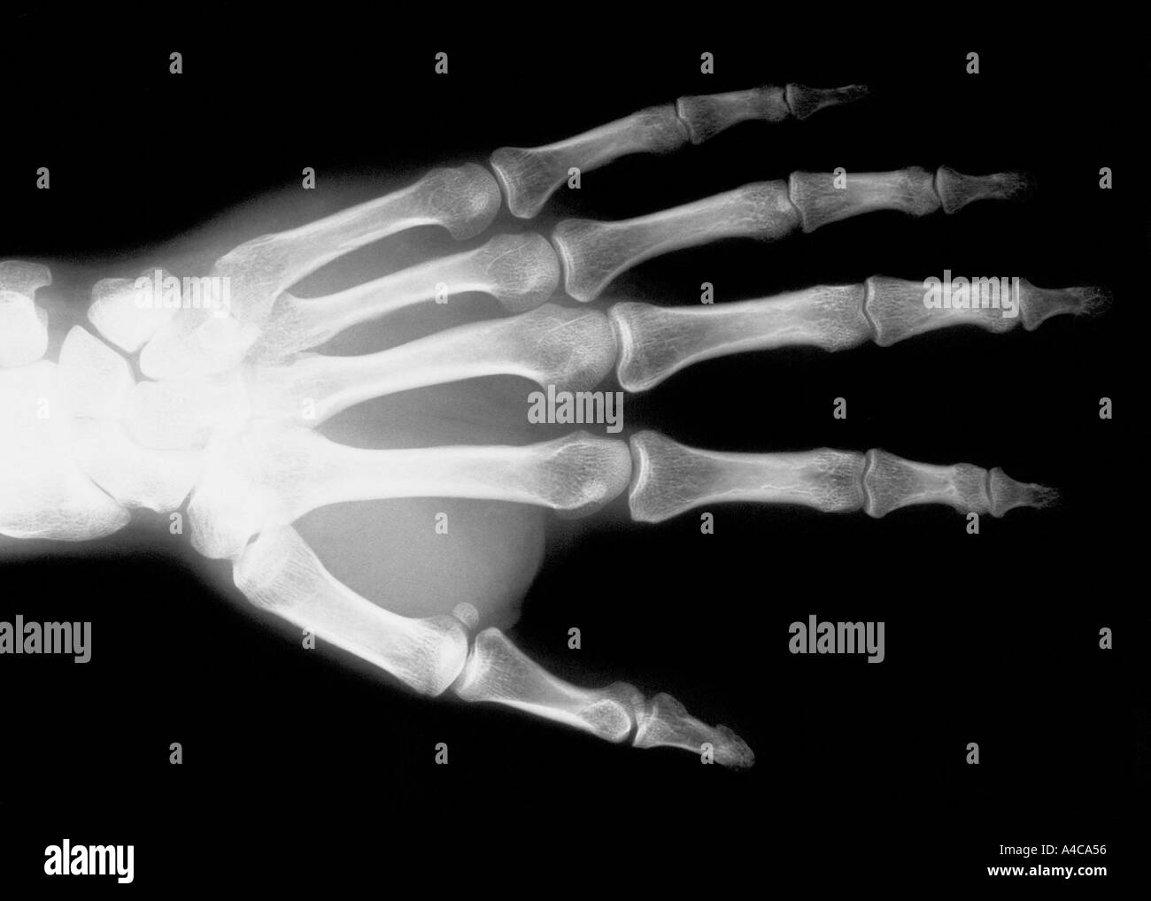 Hand skeleton hi-res stock photography and images - Alamy