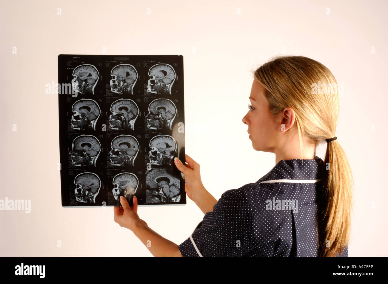 Woman x ray nhs hi-res stock photography and images - Alamy