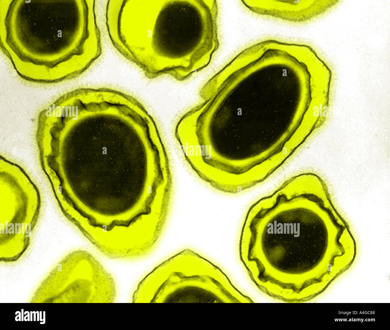 Anthrax spores from a US Department of Defense electron microscope ...