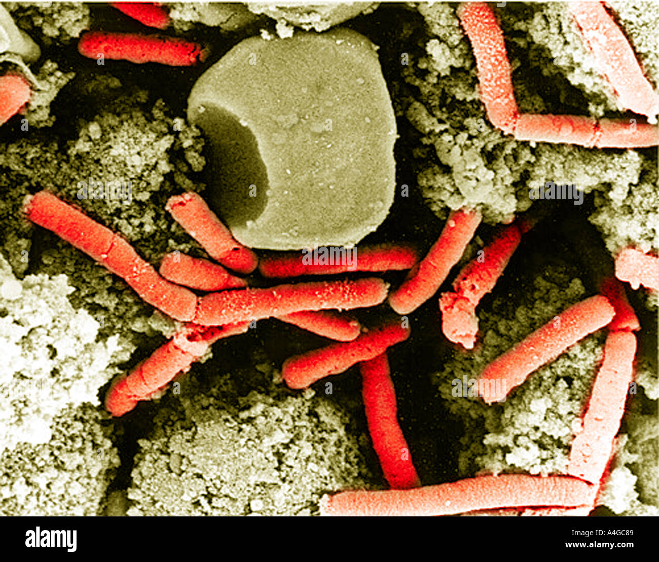 Anthrax Bacillus anthracis vegetative cells in monkey spleen Stock ...