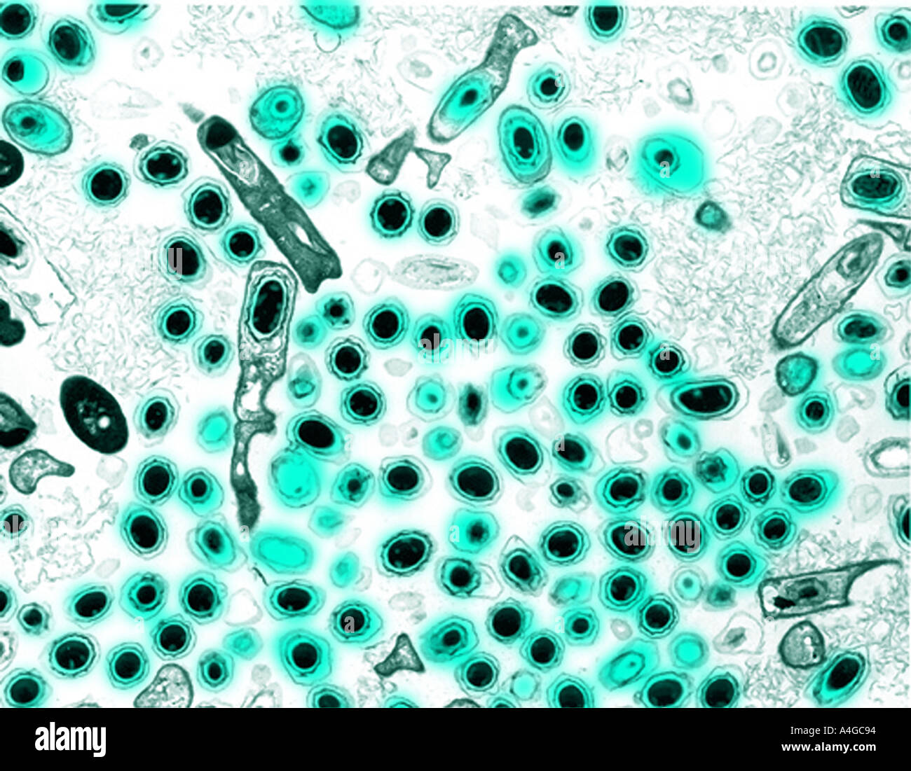 Anthrax spores from a US Department of Defense electron micrograph ...