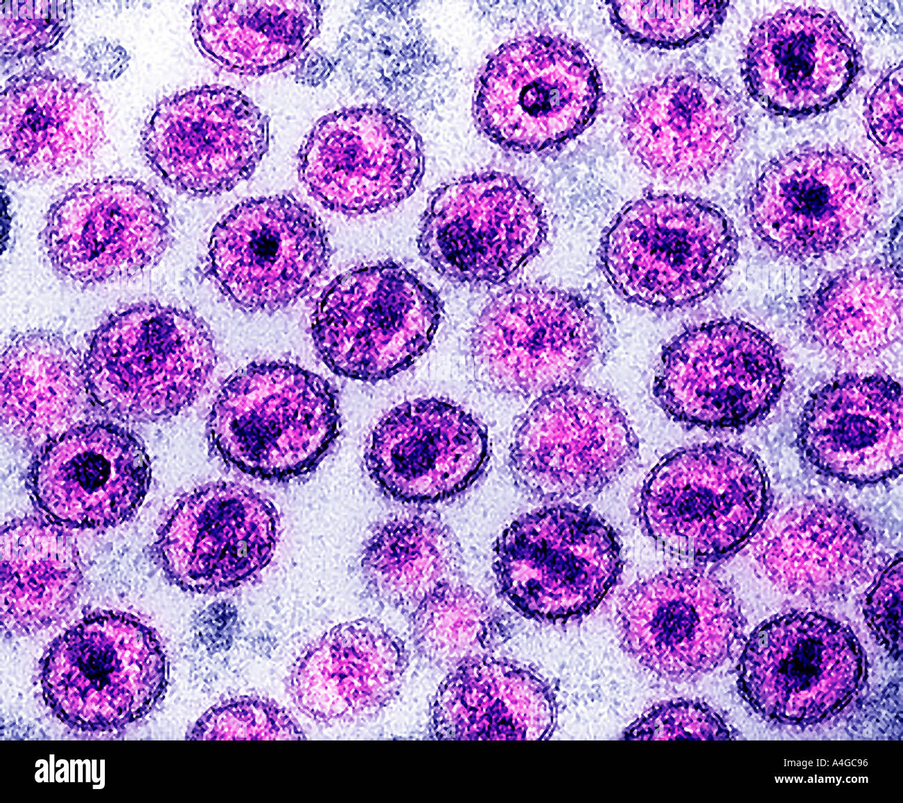 Tem transmission electron microscope aids hi-res stock photography and ...
